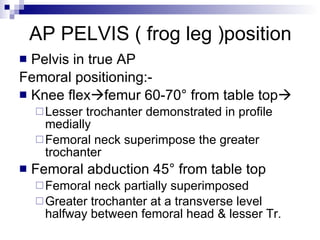 Ie 6 Pelvic Girdle | PPT | Death, Injury, or Military Conflict ...
