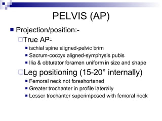 Ie 6 Pelvic Girdle | PPT | Death, Injury, or Military Conflict ...