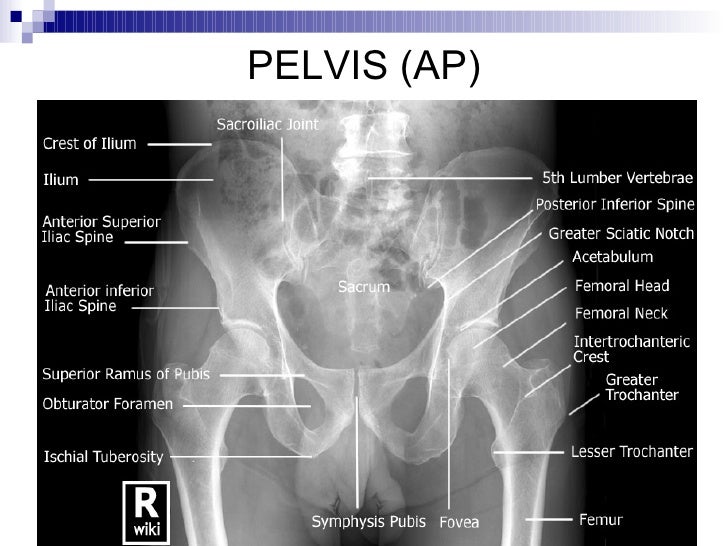 Ie 6 Pelvic Girdle
