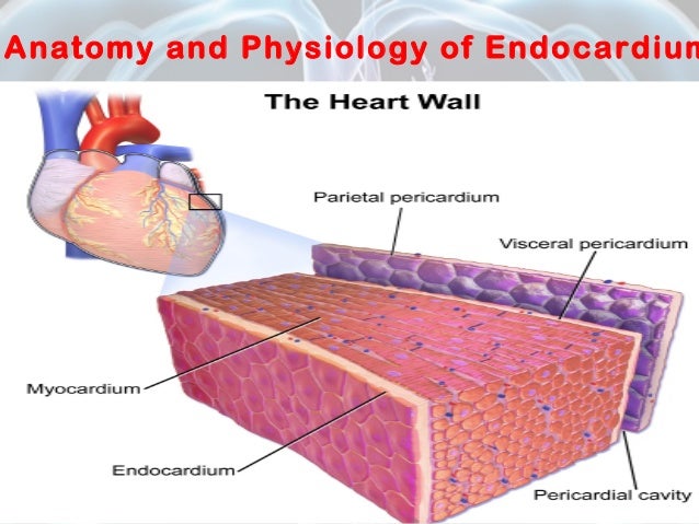 Infective Endocarditis