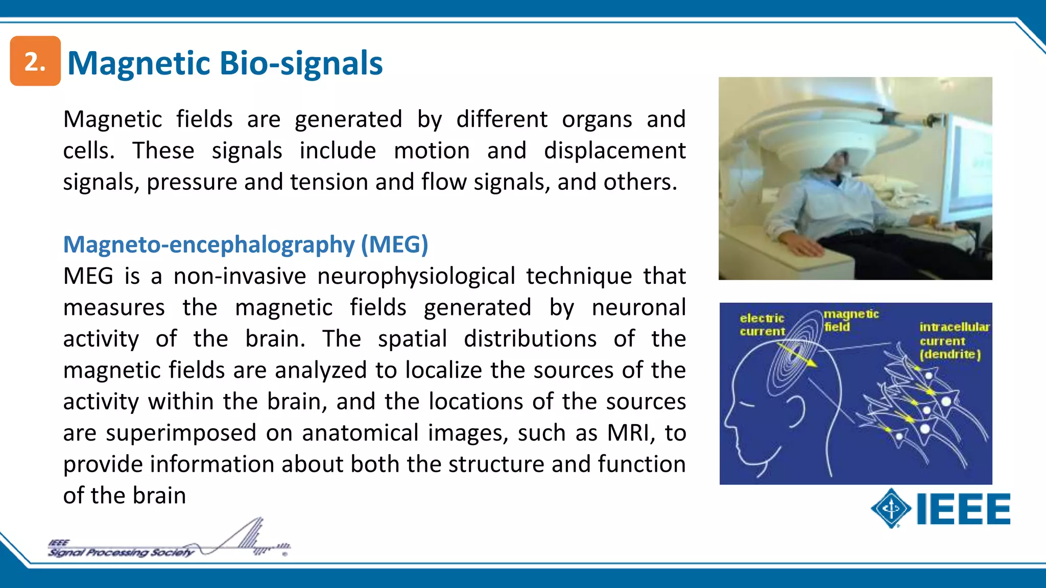 Biomedical Signal Processing / Biomedical Signals/ Bio-signals/ Bio-signals Classification | PPTX
