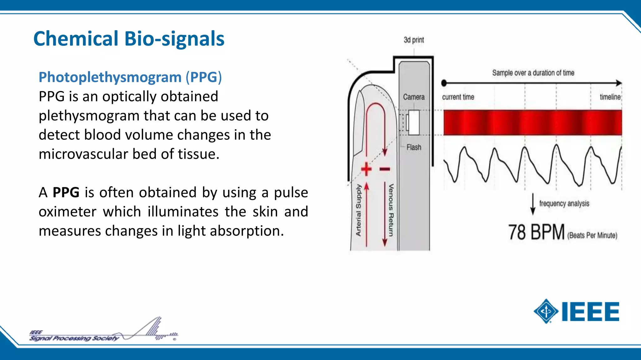 Biomedical Signal Processing Biomedical Signals Bio Signals Bio Signals Classification Ppt