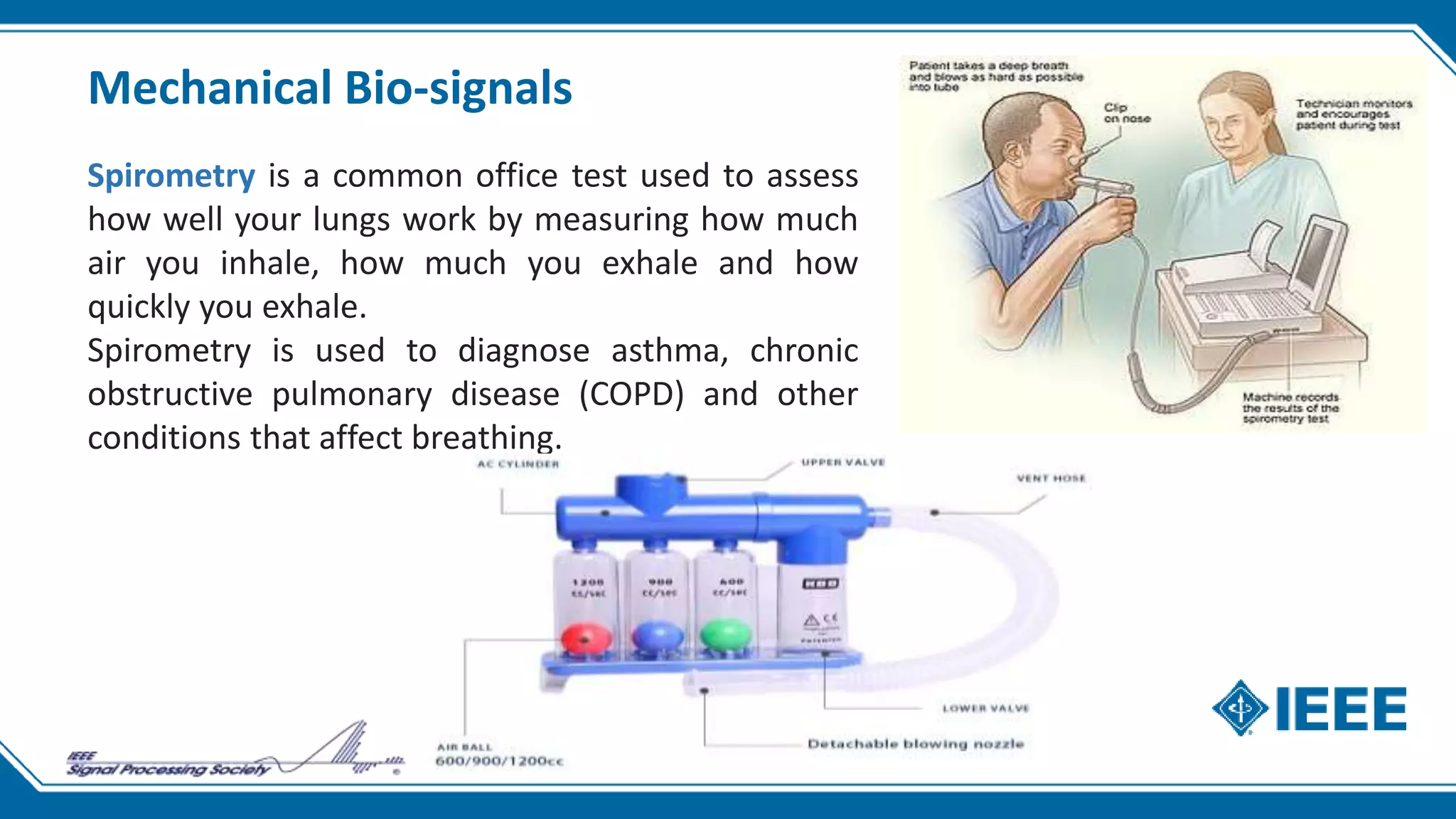 Biomedical Signal Processing Biomedical Signals Bio Signals Bio Signals Classification Ppt