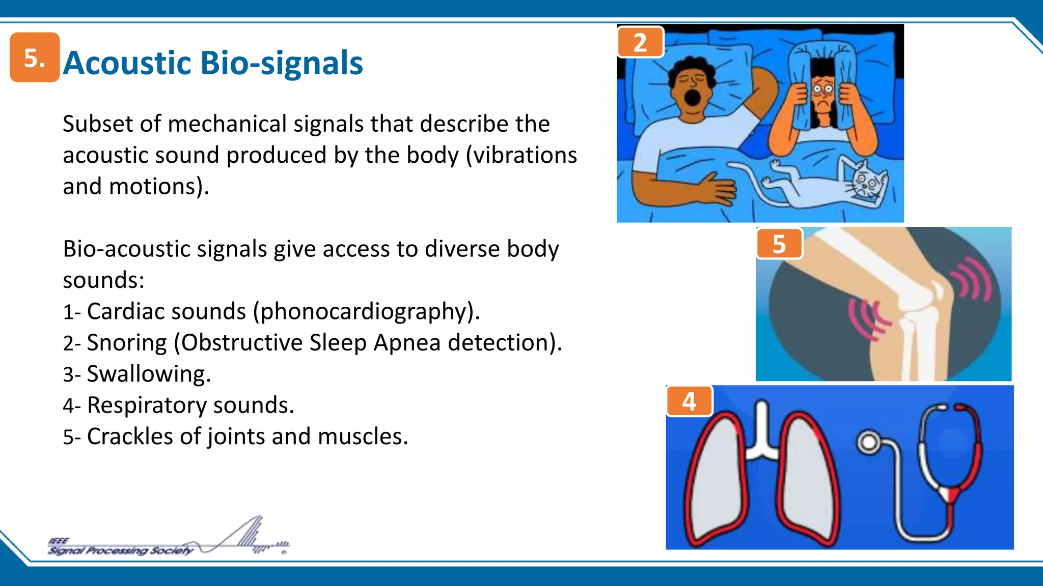 Biomedical Signal Processing Biomedical Signals Bio Signals Bio Signals Classification Ppt