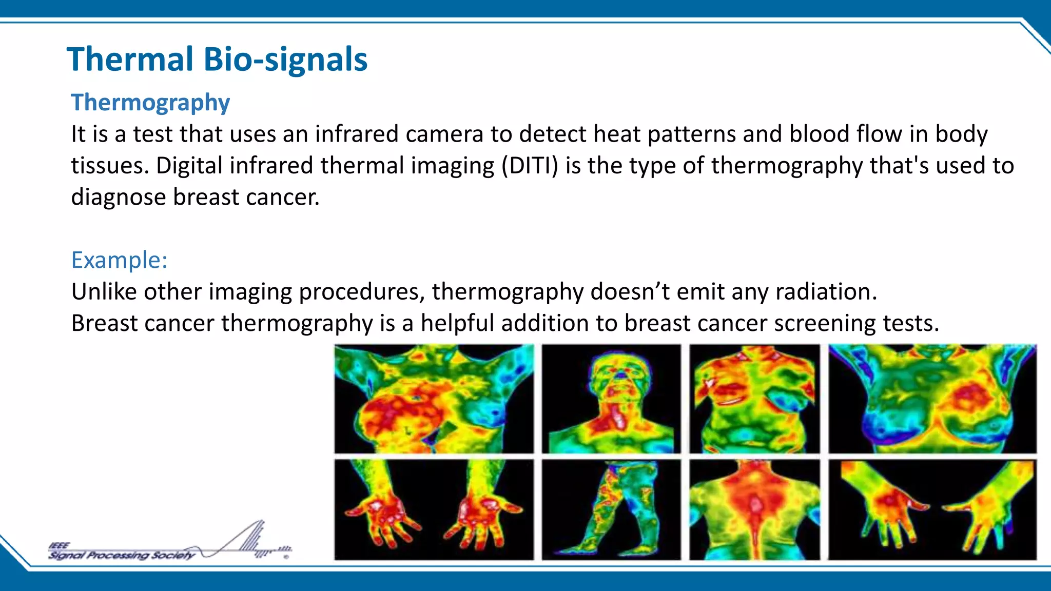 Biomedical Signal Processing / Biomedical Signals/ Bio-signals/ Bio ...