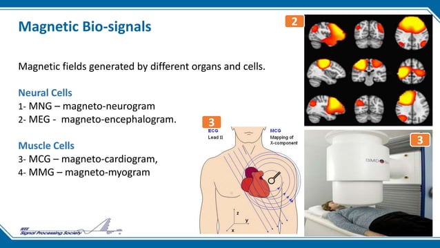 Biomedical Signal Processing / Biomedical Signals/ Bio-signals/ Bio ...