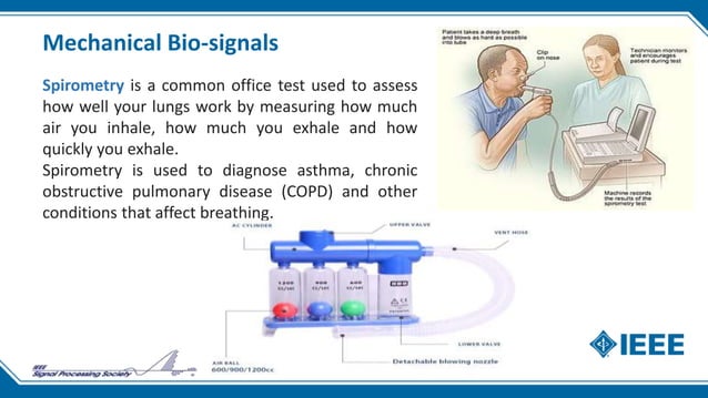 Biomedical Signal Processing / Biomedical Signals/ Bio-signals/ Bio ...