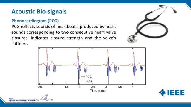 Biomedical Signal Processing / Biomedical Signals/ Bio-signals/ Bio ...