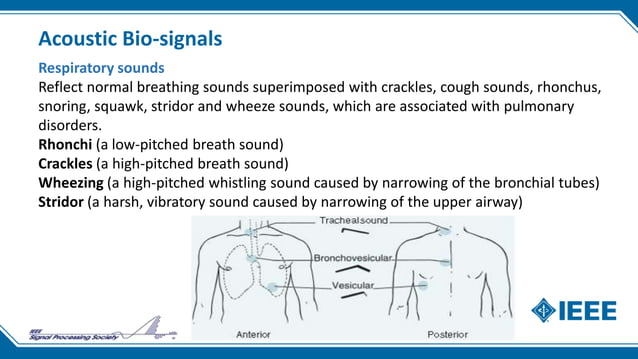 Biomedical Signal Processing / Biomedical Signals/ Bio-signals/ Bio ...