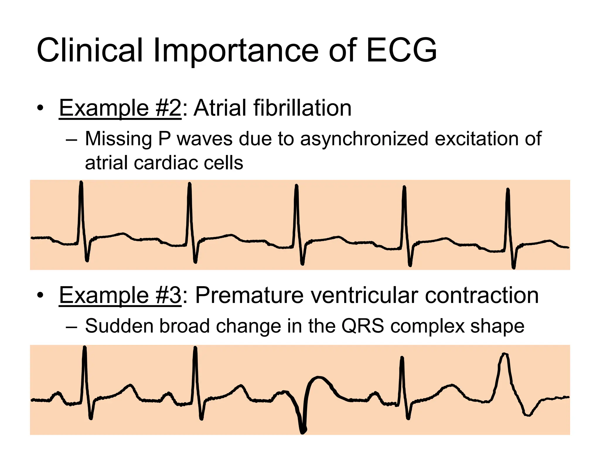 IEEE ECPhysiological origin: Sequential electrical activation of ...