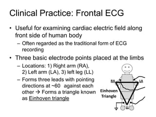 IEEE ECPhysiological origin: Sequential electrical activation of ...