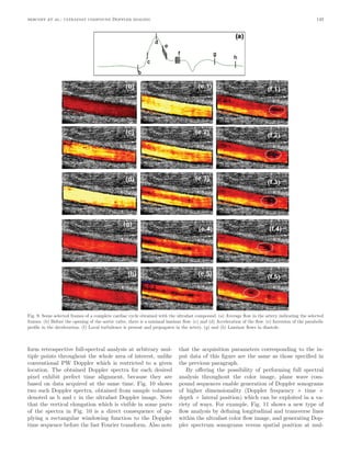Ieee jan 2011 ultrafast compound doppler imaging providing full blood ...
