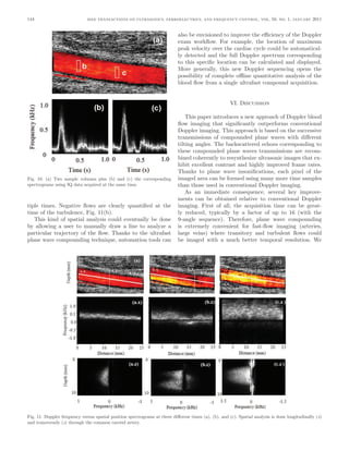 Ieee jan 2011 ultrafast compound doppler imaging providing full blood ...