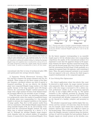 Ieee jan 2011 ultrafast compound doppler imaging providing full blood ...