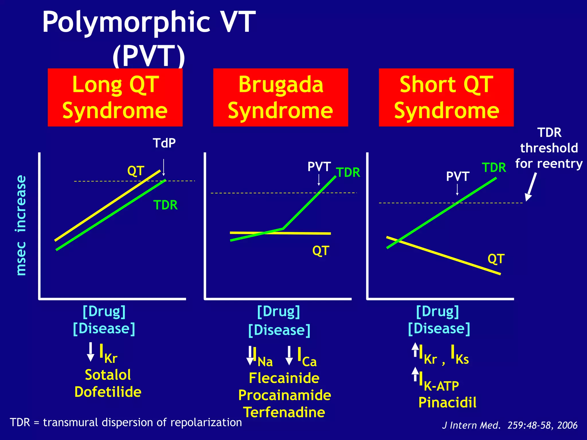 Repolarização Precoce - por Dr. André D´Avila | PDF