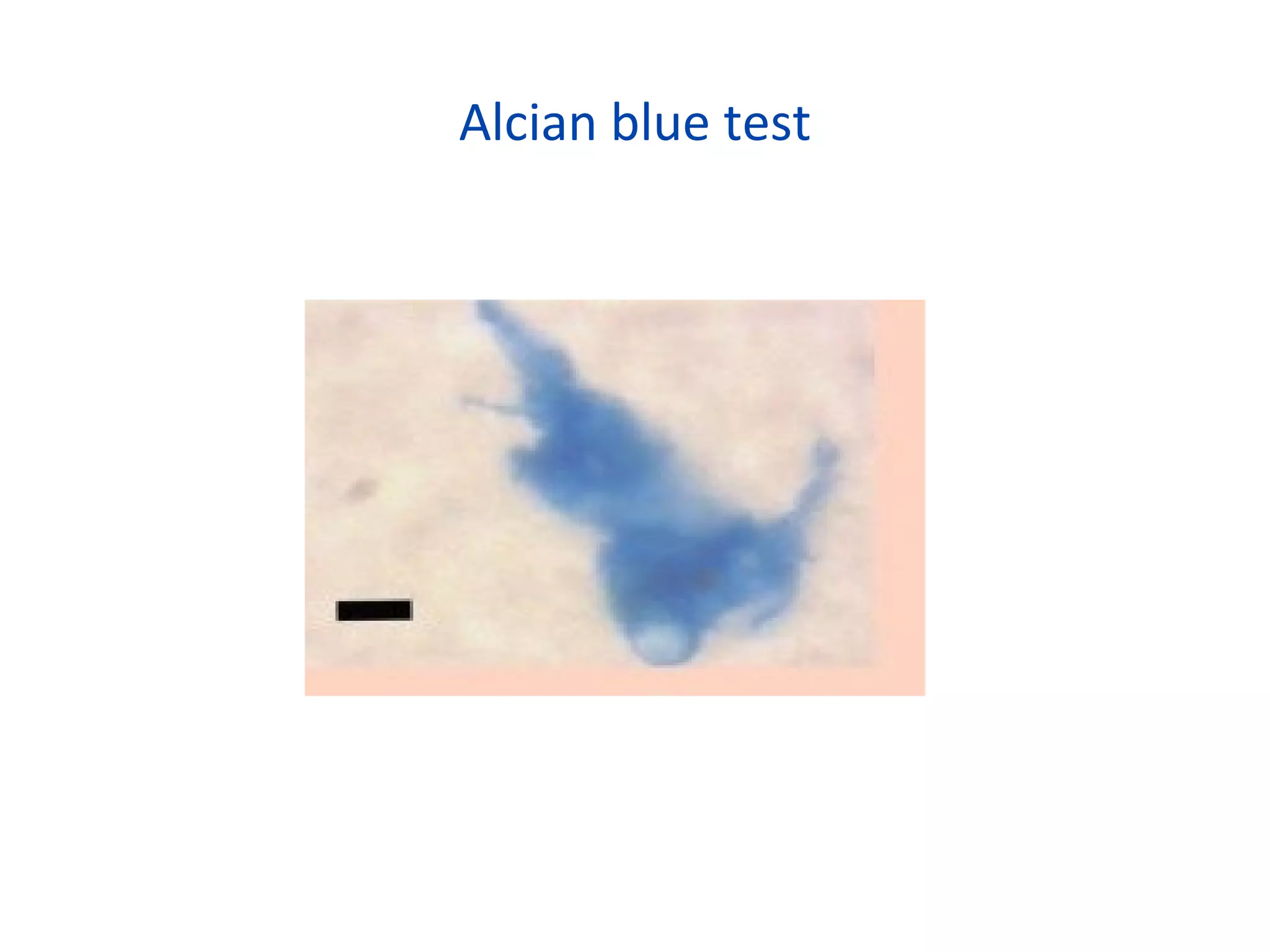 Screening for Inborn Errors of metabolism | PPT