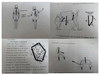 Patellar tendon bearing prosthesis | PPTX