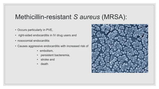Infective endocarditis/ endocarditis | PPTX