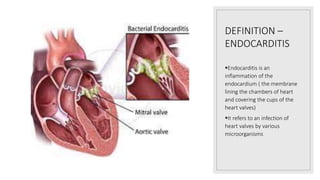 Infective endocarditis/ endocarditis | PPTX