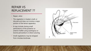 Infective Endocarditis- surgical indication & principle of surgery | PPTX