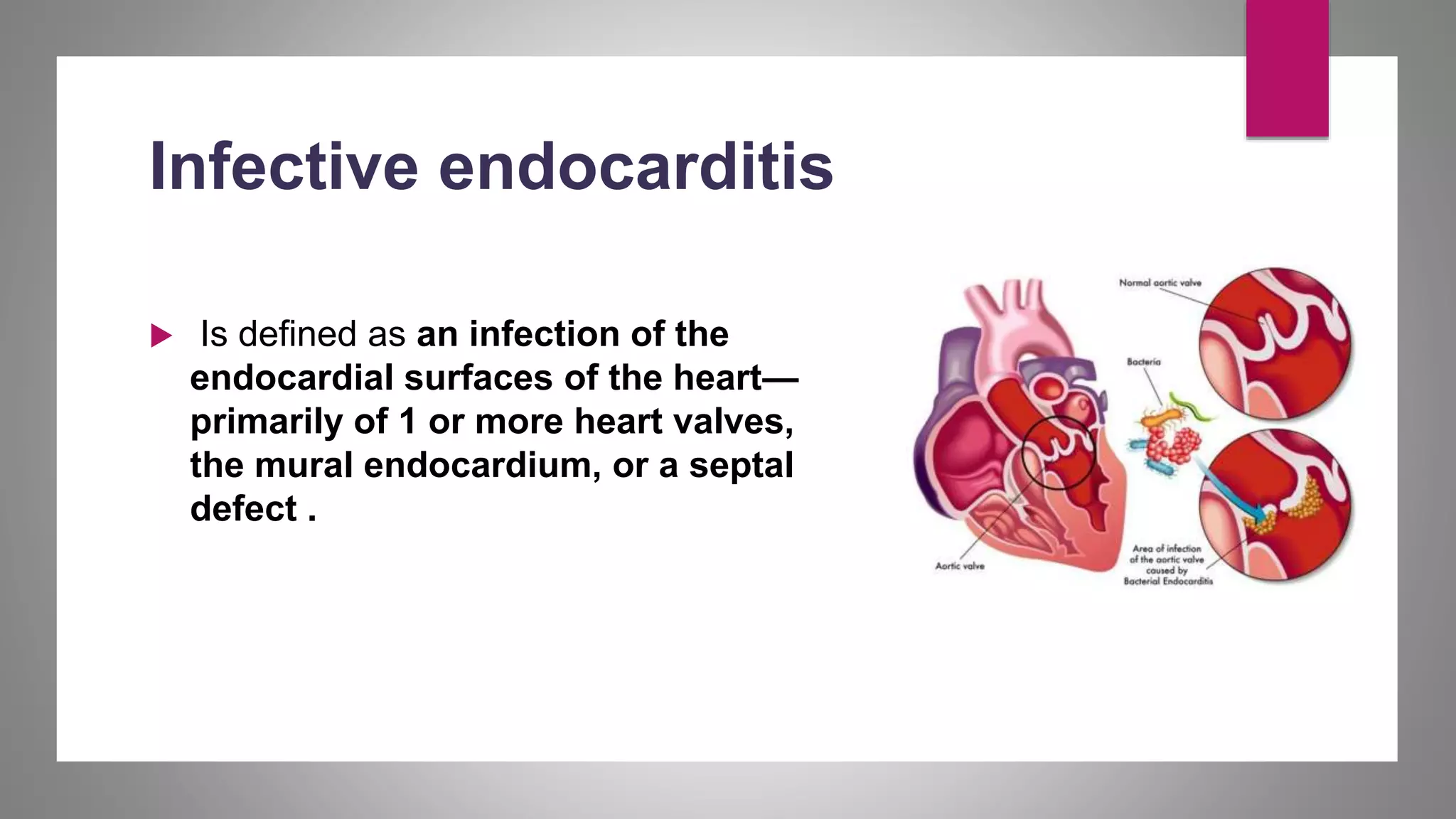 Infective Endocarditis - Indications of Surgery | PPTX