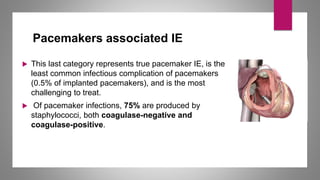 Infective Endocarditis - Indications of Surgery | PPTX