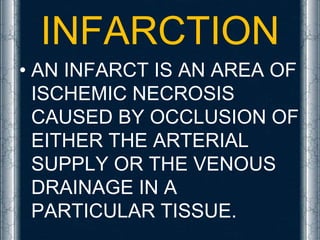 Infarction | PPT