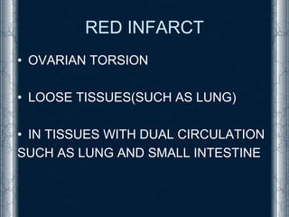 Infarction | PPT