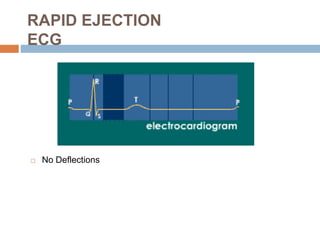 Cardiac cycle | PPT