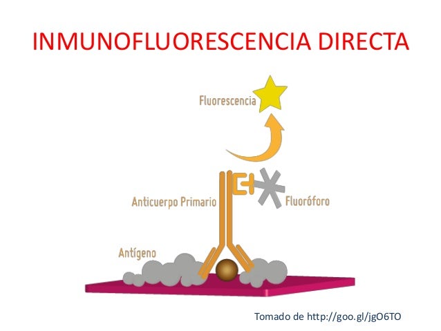 Prueba IFAT (inmunofluorescencia directa e indirecta)