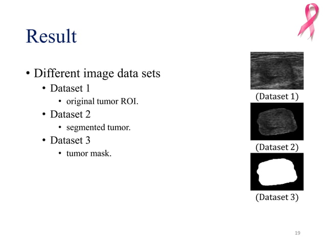 Computer‐Aided Diagnosis of Breast Cancer Using Ensemble Convolutional Neural Networks ...