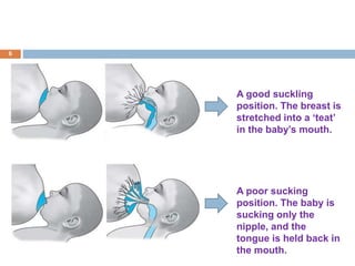 Infant Feeding Practices | PPTX