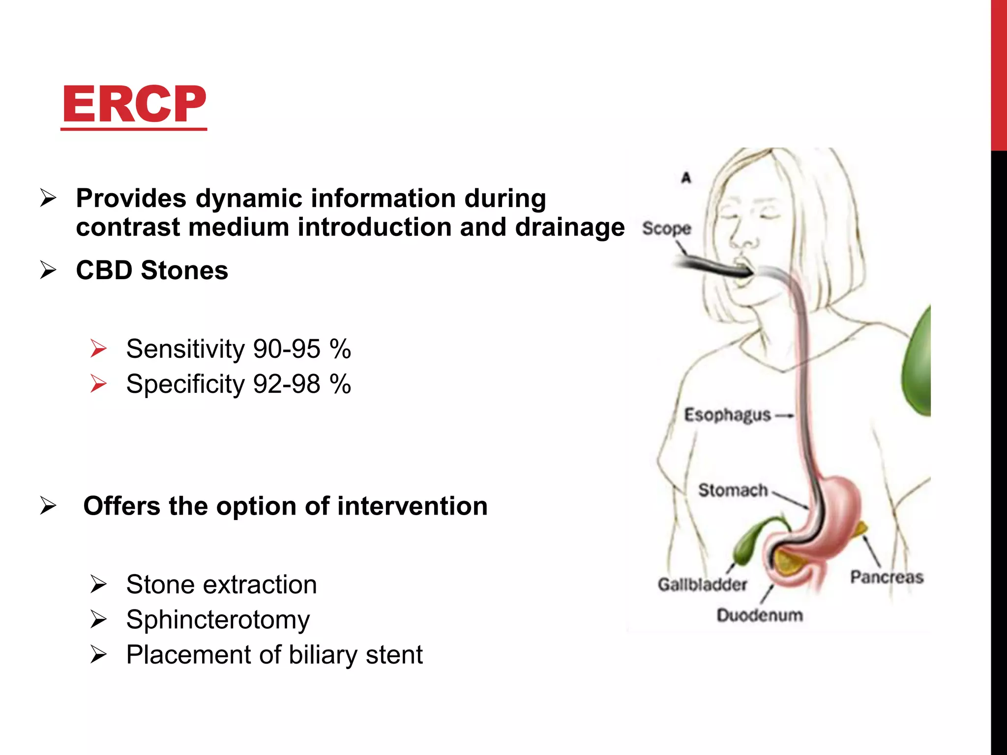investigations and management of obstructive jaundice secondary to ...