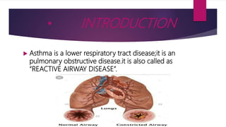 asthma | PPTX