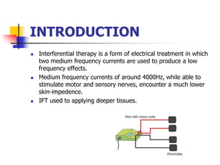 INTERFERENTIAL THERAPY | PPT