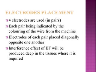 Interferential Therapy (IFT) | PPTX