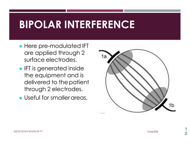 Interferential Therapy / Interferential Current (IFC) I Physiotherapy ...