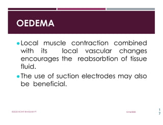 Interferential Therapy / Interferential Current (IFC) I Physiotherapy ...