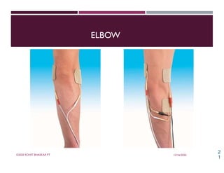 Interferential Therapy / Interferential Current (IFC) I Physiotherapy ...