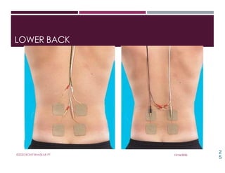 Interferential Therapy / Interferential Current (IFC) I Physiotherapy ...