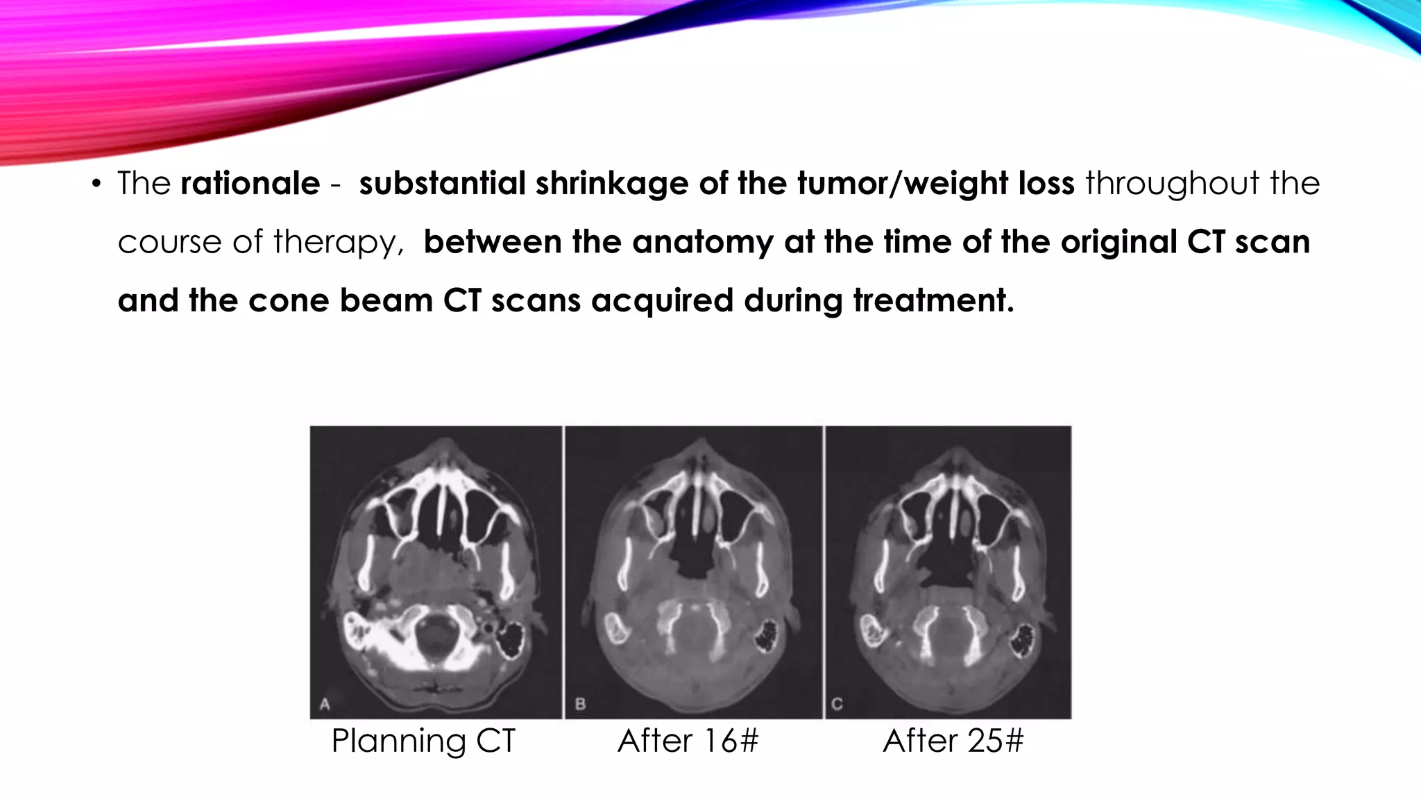 Image guided adaptive radiotherapy | PDF
