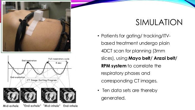 Image guided adaptive radiotherapy