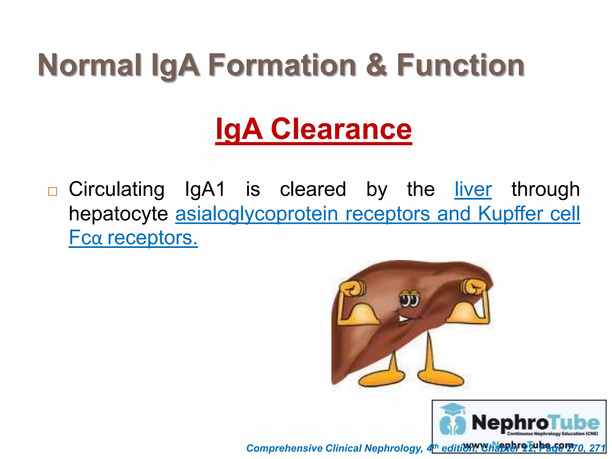 IgA NEPHROPATHY (CLOSING THE LOOP) - Dr. Gawad | PPTX