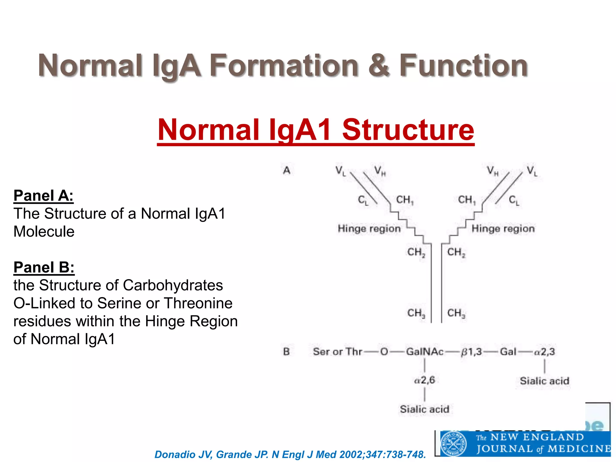 IgA NEPHROPATHY (CLOSING THE LOOP) - Dr. Gawad | PPTX