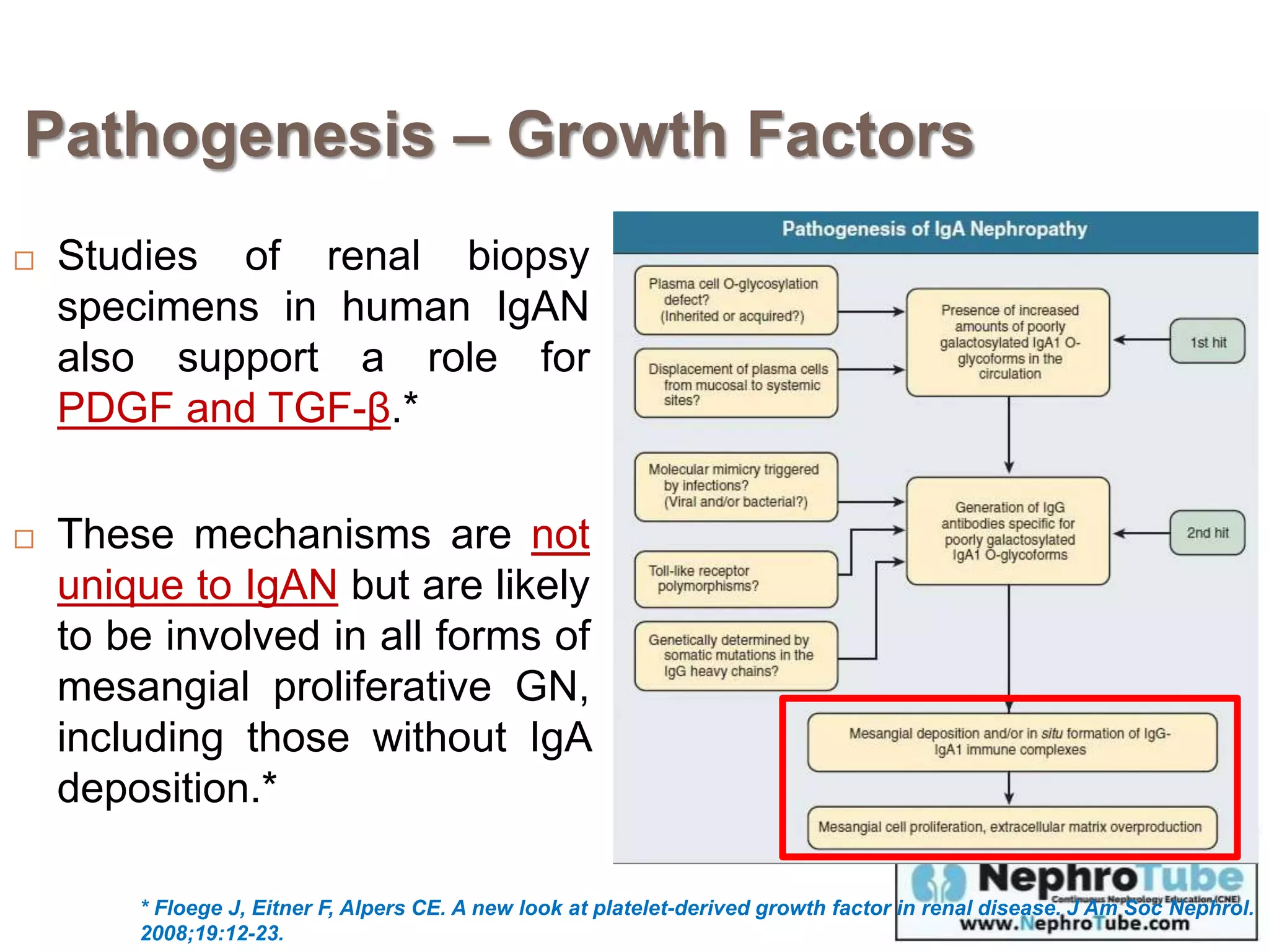 IgA NEPHROPATHY (CLOSING THE LOOP) - Dr. Gawad | PPTX