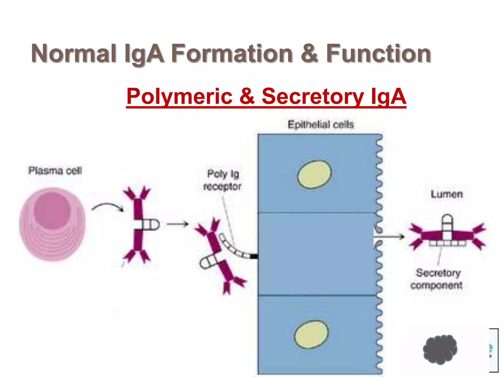 IgA NEPHROPATHY (CLOSING THE LOOP) - Dr. Gawad | PPTX