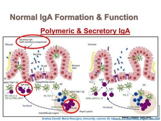 IgA NEPHROPATHY (CLOSING THE LOOP) - Dr. Gawad | PPTX