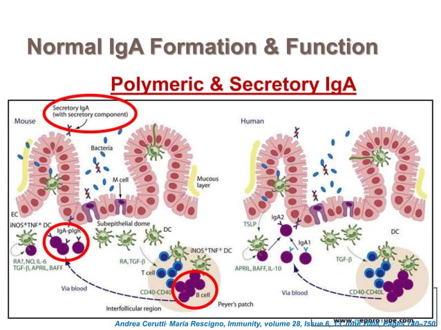 IgA NEPHROPATHY (CLOSING THE LOOP) - Dr. Gawad | PPTX