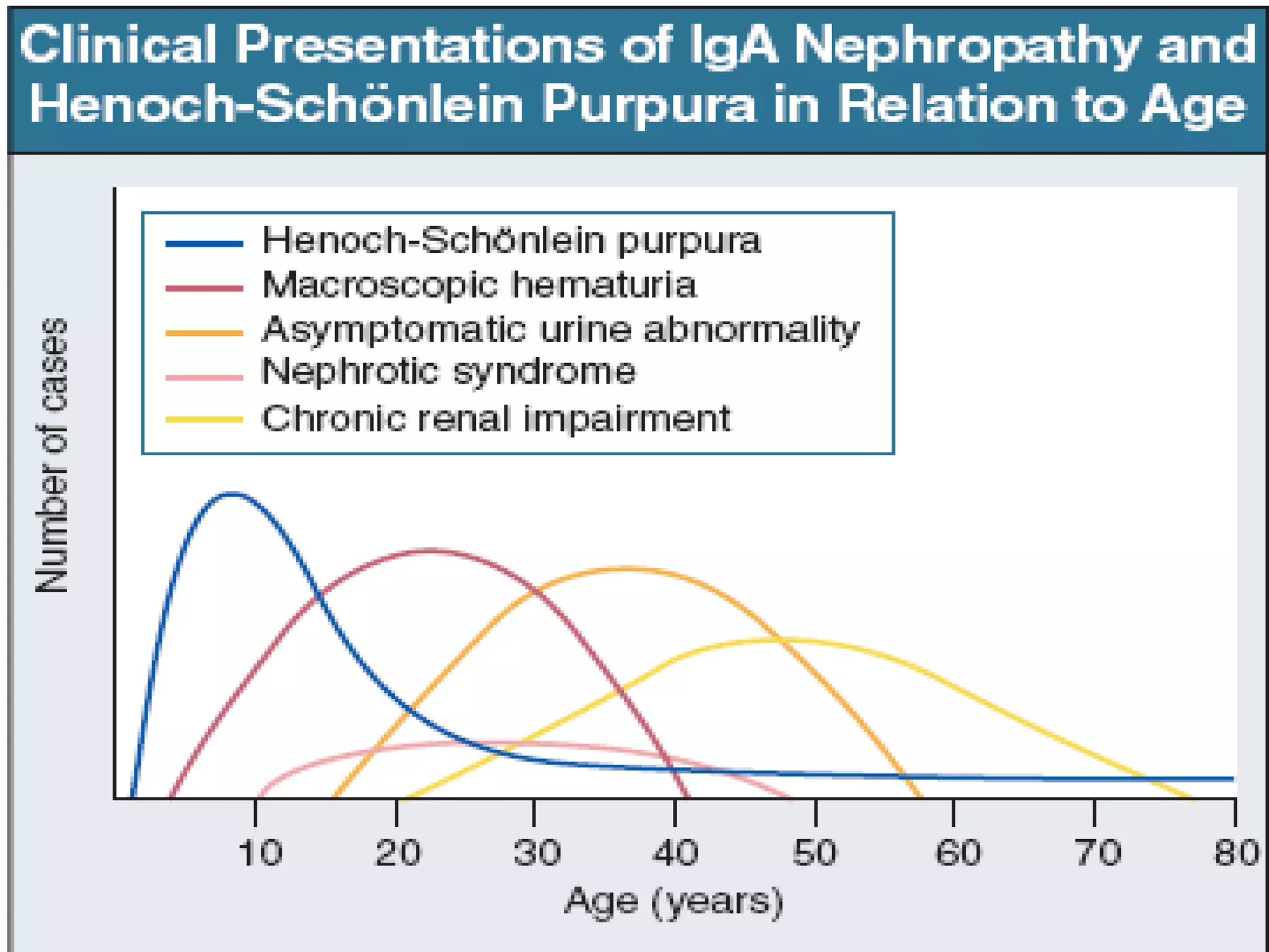 IgA nephropathy | PPT