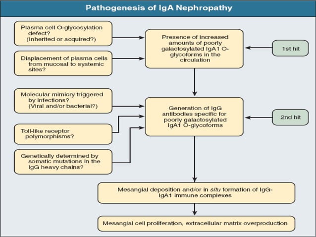 IgA nephropathy | PPT